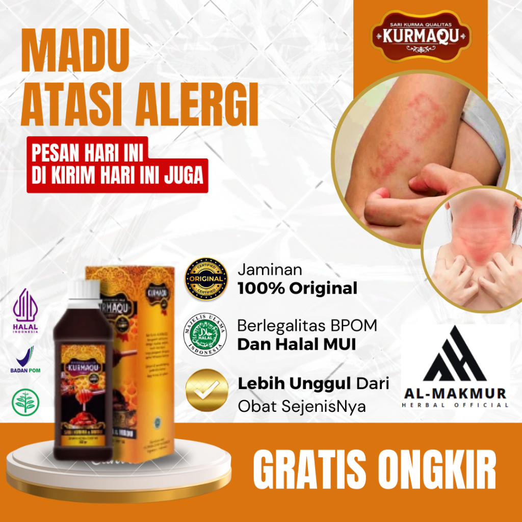 Jual Obat Alergi, Obat Gatal Biduran, Obat Alami Kaligata Menahun, Obat ...