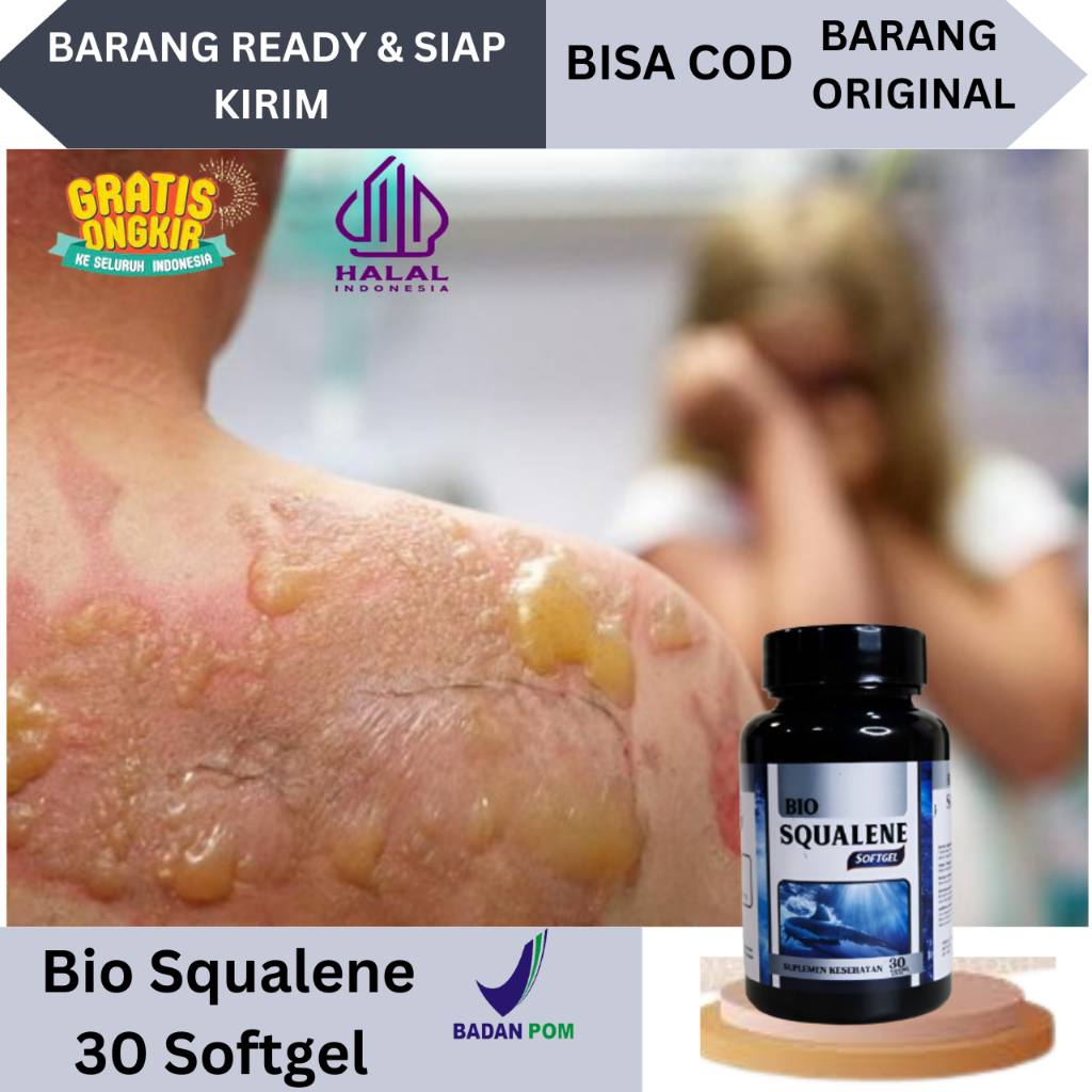 Jual Obat Luka Bakar Melepuh Obat Luka Bakar Agar Cepat Kering Obat ...