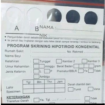 Jual Kertas Saring SHK ( Satuan ) Skrining Hipotiroid / Skrinning ...