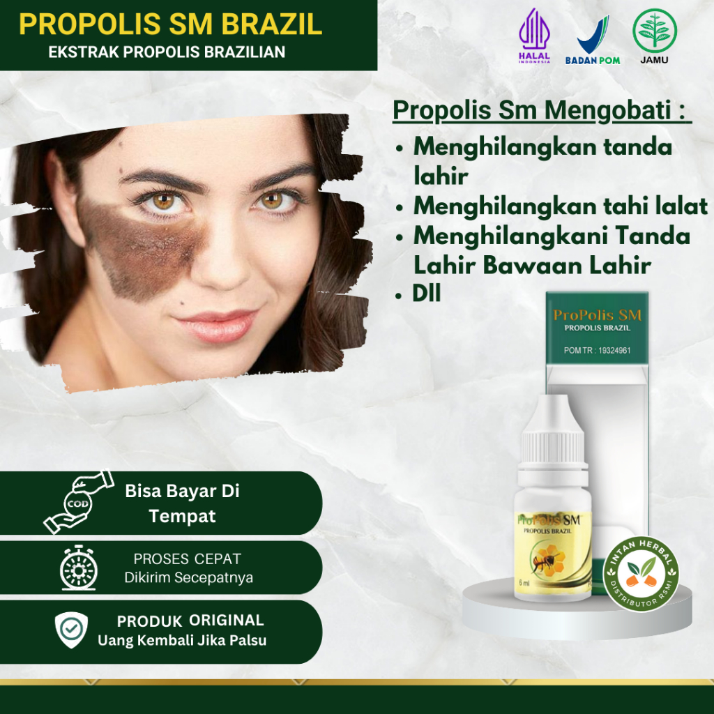 Jual Propolis SM 6ml - Obat Penghilang Tanda Lahir, Tanda Lahir Coklat ...