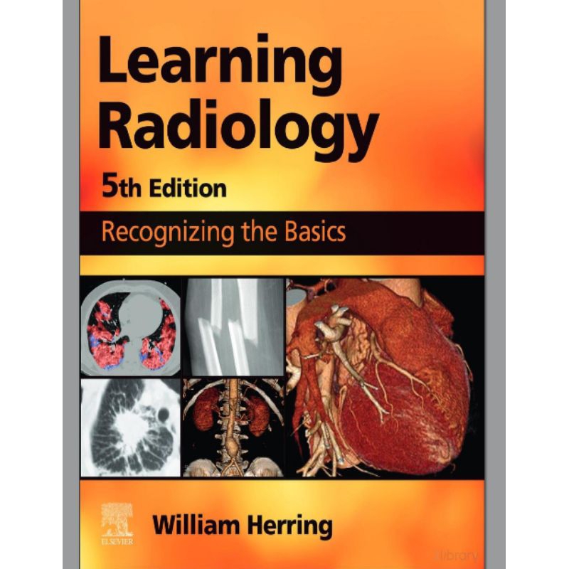 Jual Buku Learning Radiology: Recognizing the Basics, 5th Edition ... Jual Buku Learning Radiology: Recognizing the Basics, 5th Edition ...