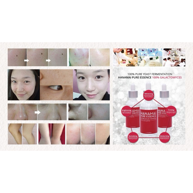 Jual HANAMAI PURE ESSENCE | Shopee Indonesia