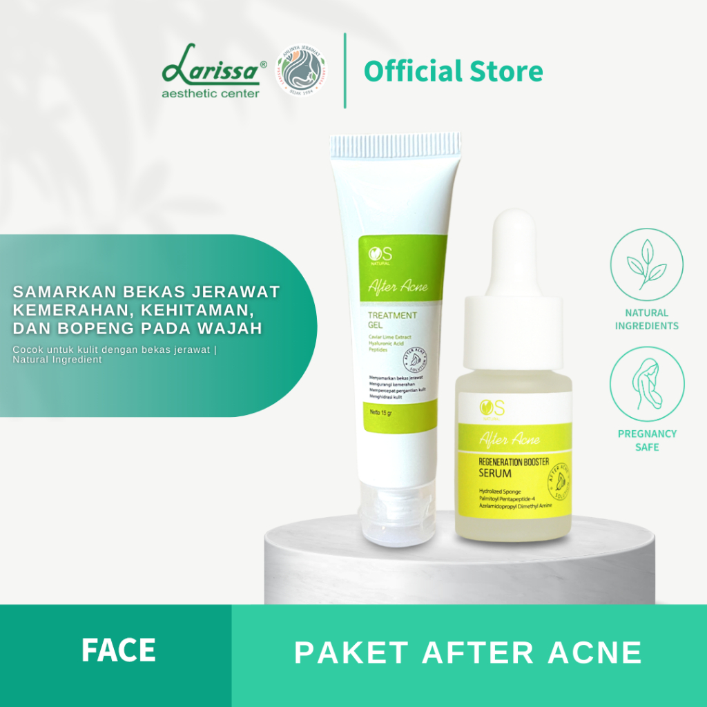 Jual Larissa Paket Bekas Jerawat - After Acne Serum + After Acne ...