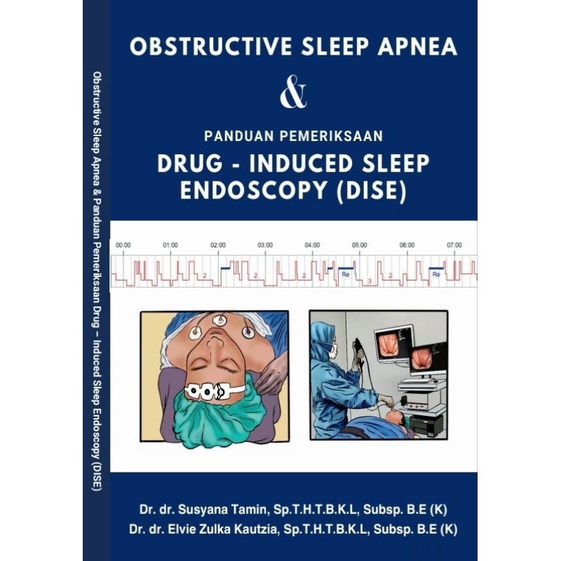 Jual Panduan Drug Induced Sleep Endoscopy (DISE) THT-KL FKUI RSCM ...