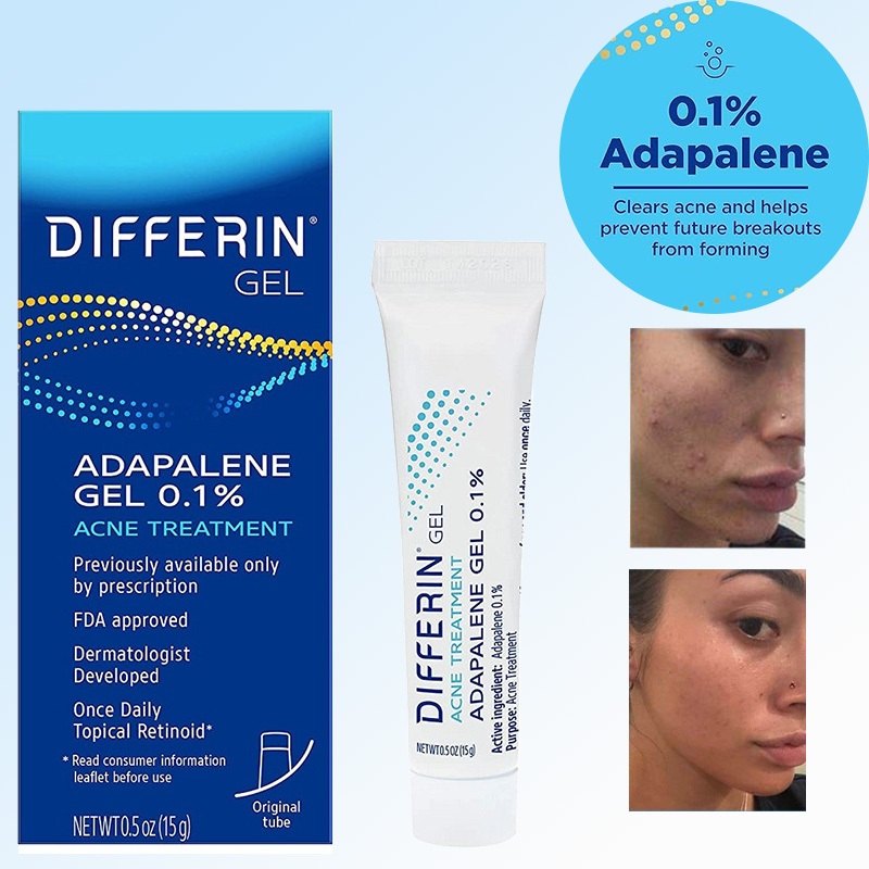 Jual Differin Acne Treatment Gel 15 gram USA | 0.1% Adapalene| krim ...