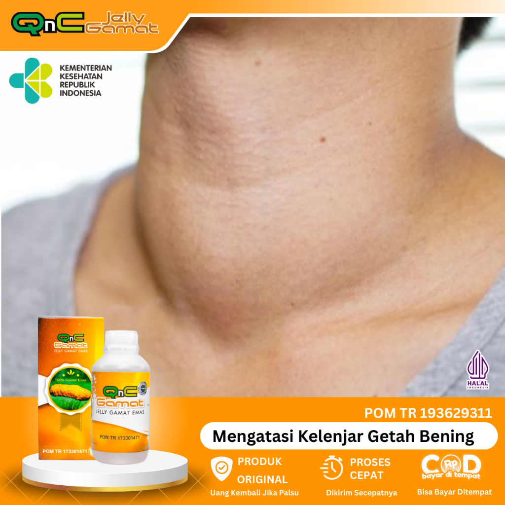 Jual Obat Kelenjar Getah Bening, Obat Benjolan Bengkak, Obat Tumor ...