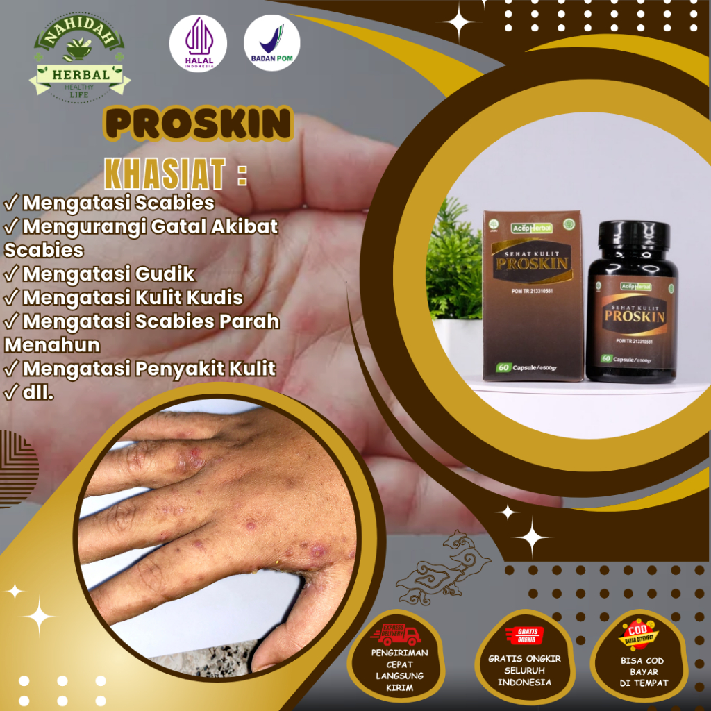 Jual Obat Scabies, Obat Scabies Benanah, Gatal - Gatal Karena Scabies ...