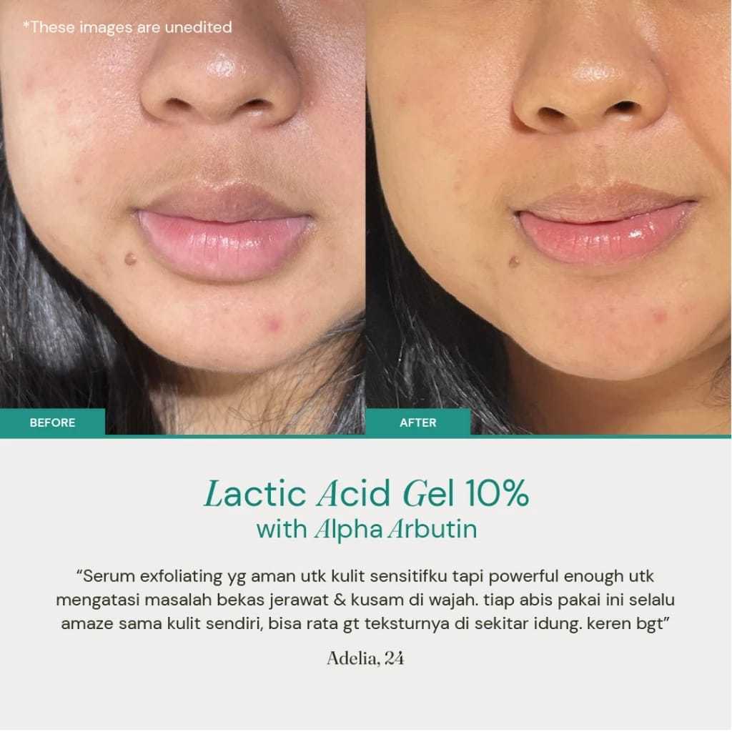 Jual FSS For Skin's Sake Glycolic Acid Gel 10% Tranexamic Acid // Lactic Acid Gel 10% Alpha ...