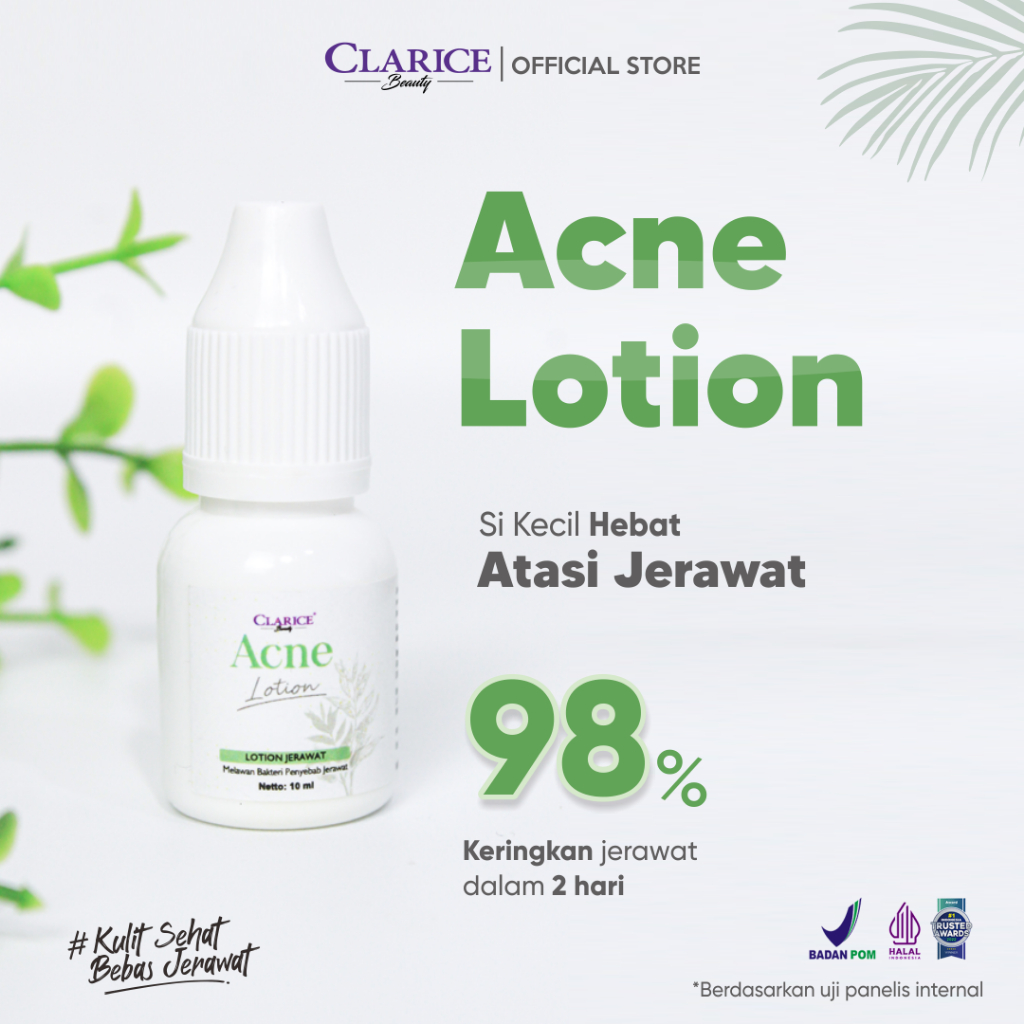 Jual CLARICE BEAUTY Acne Lotion 10ML | Obat Jerawat | Shopee Indonesia