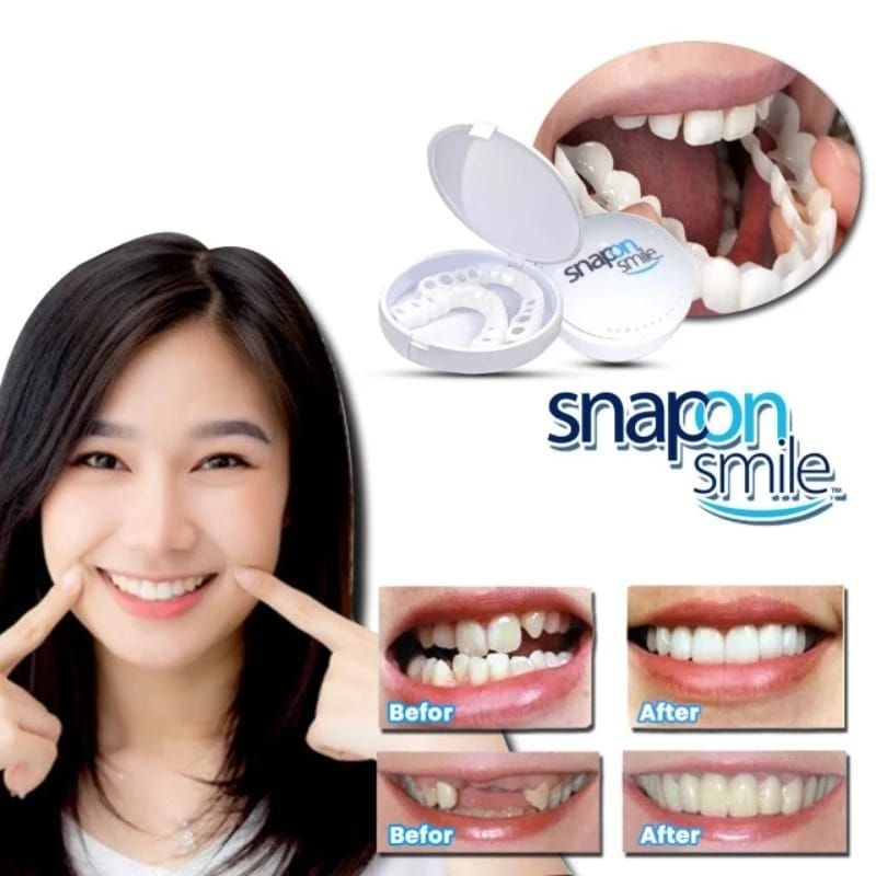 Jual Snap On Smile Gigi Palsu 1 Set Atas Bawah - Gigi Palsu Silikon terbaik 100% original ...