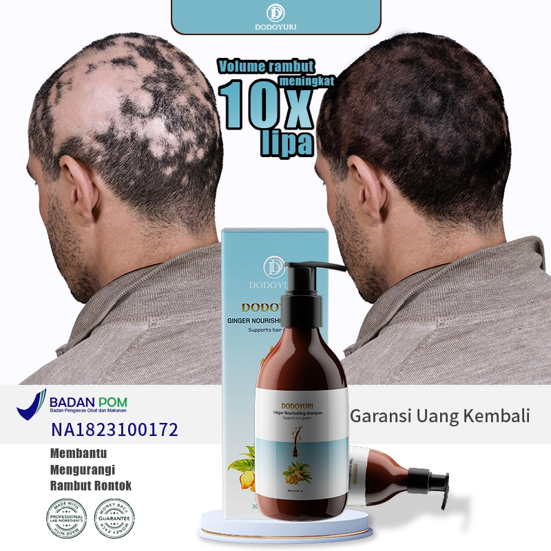 Jual DODOYURI Shampoo penumbuh rambut cepat Shampoo anti rontok Keratin ...