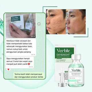 Jual FREE GIFT-VERBLE DAY AND NIGHT SERUM BEKAS LUKA BERLUBANG - VERBLE ...