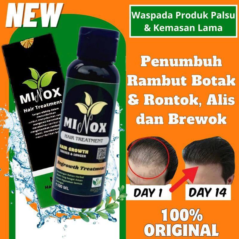 Jual [MINOX] Penumbuh Rambut Botak, Tipis dan Rontok Super Cepat ...