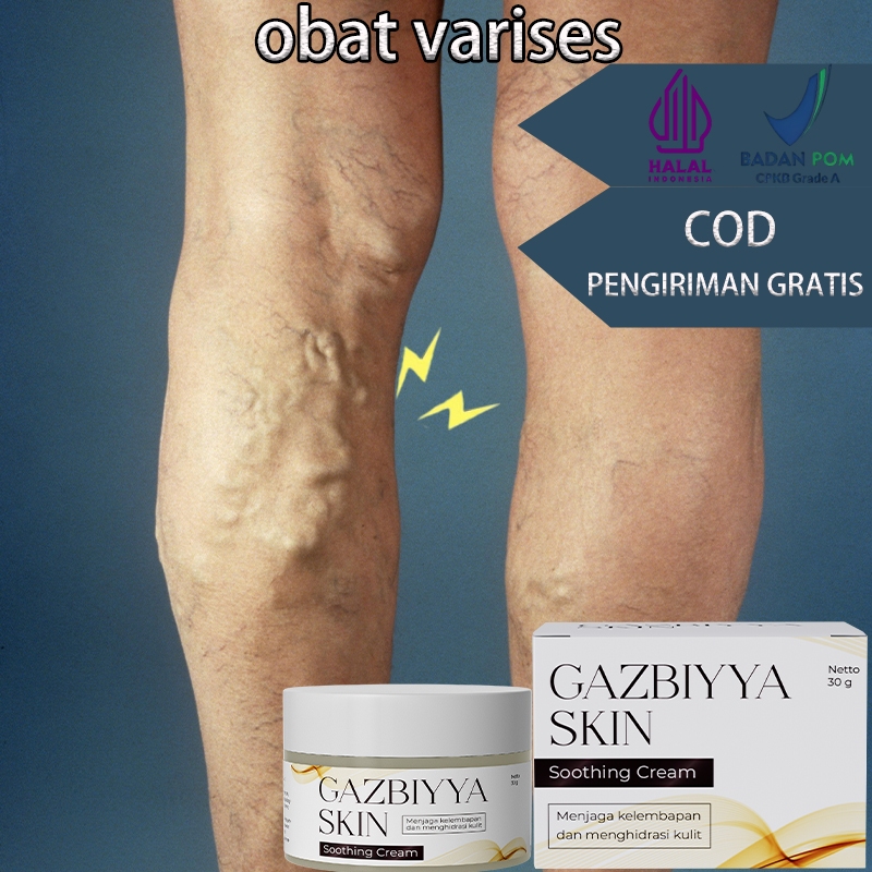 Jual Obat varises kaki valesin obat varises original salep varises obat ...