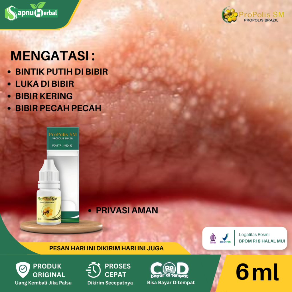 Jual Obat Bintik Putih Di Bibir, Obat Penghilang Bintik Putih, Obat ...
