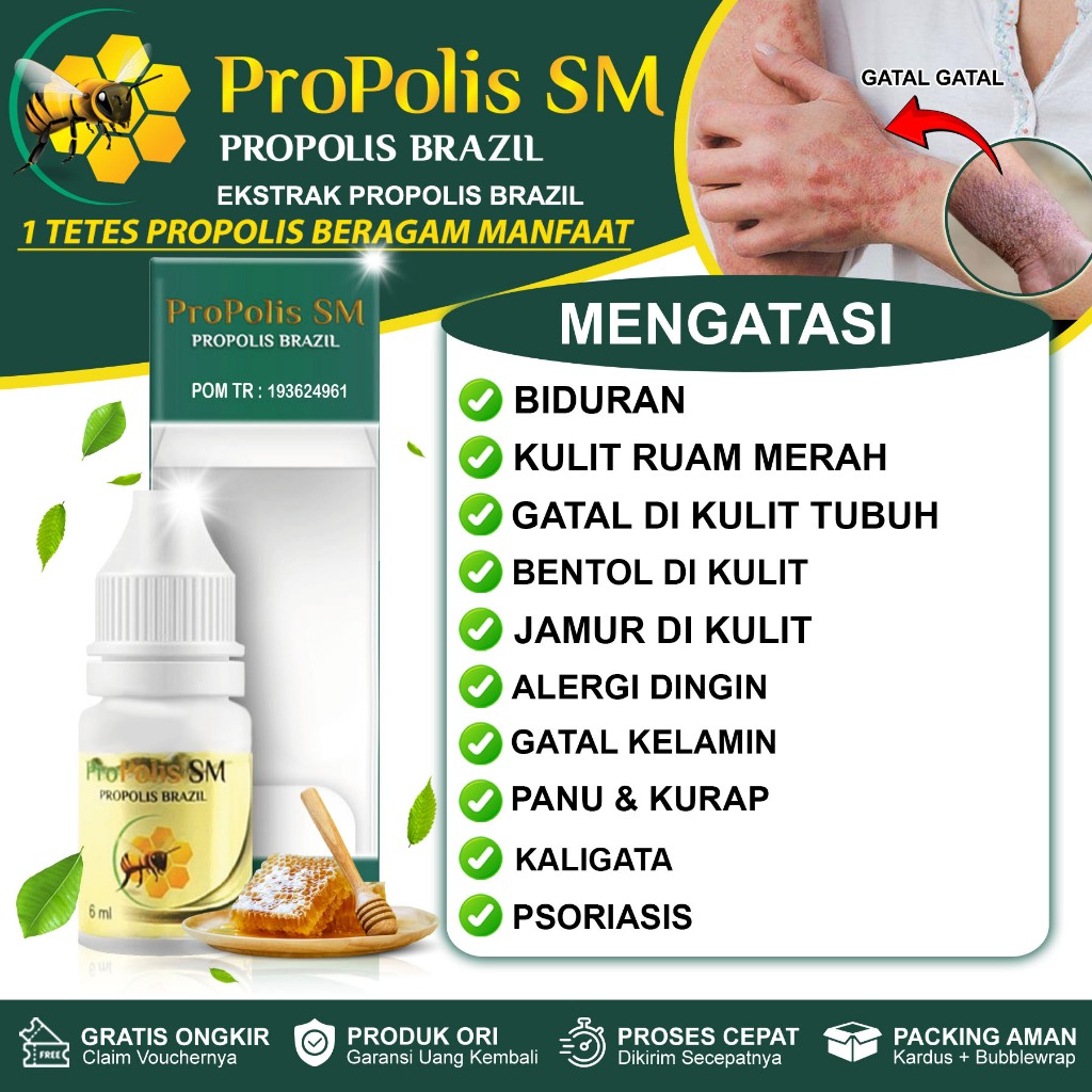 Jual Obat Biduran Alergi Dingin Dan Gatal Kaligata Kulit Bentol-Bentol ...