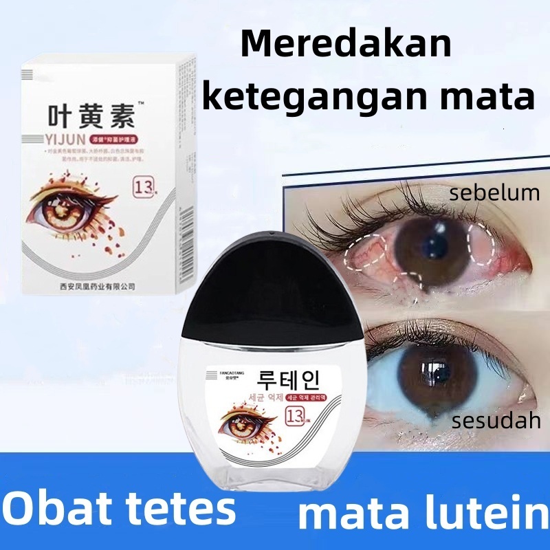 Jual Obat tetes/mata katarak/Menyejukkan Mata/Mata Kering/Sakit Mata ...