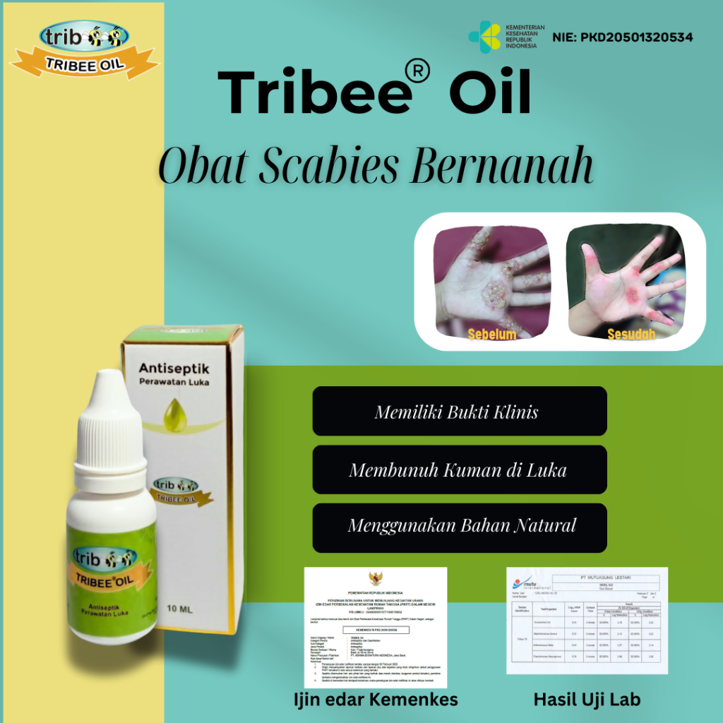Jual Tribee Oil Obat Luka Scabies, Kutu Busuk, Kutu Kasur, Luka Scabies ...