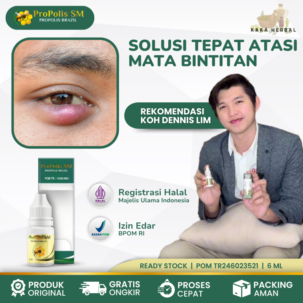 Jual Obat Mata Bintitan, Obat Mata Kalazion, Obat Benjolan Di Kelopak ...