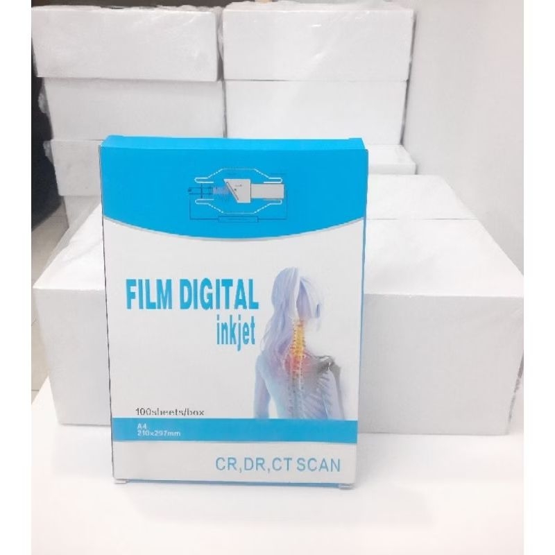 Jual Film Inkjet Radiologi ukuran A4 ( CR, DR dan CT Scan ) | Shopee ...