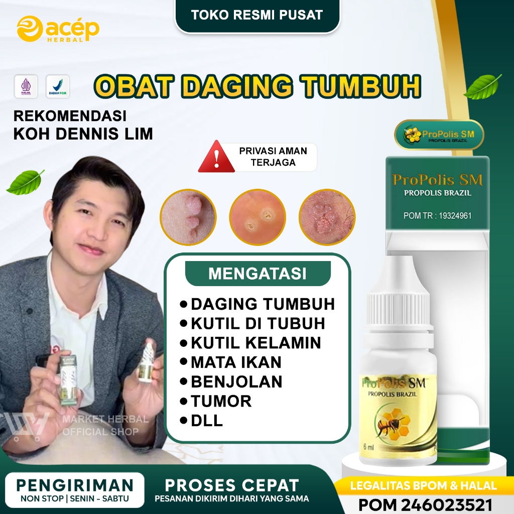 Jual Obat Kutil Penghilang Mata Ikan Kutil Kelamin Papiloma Skin Tag ...
