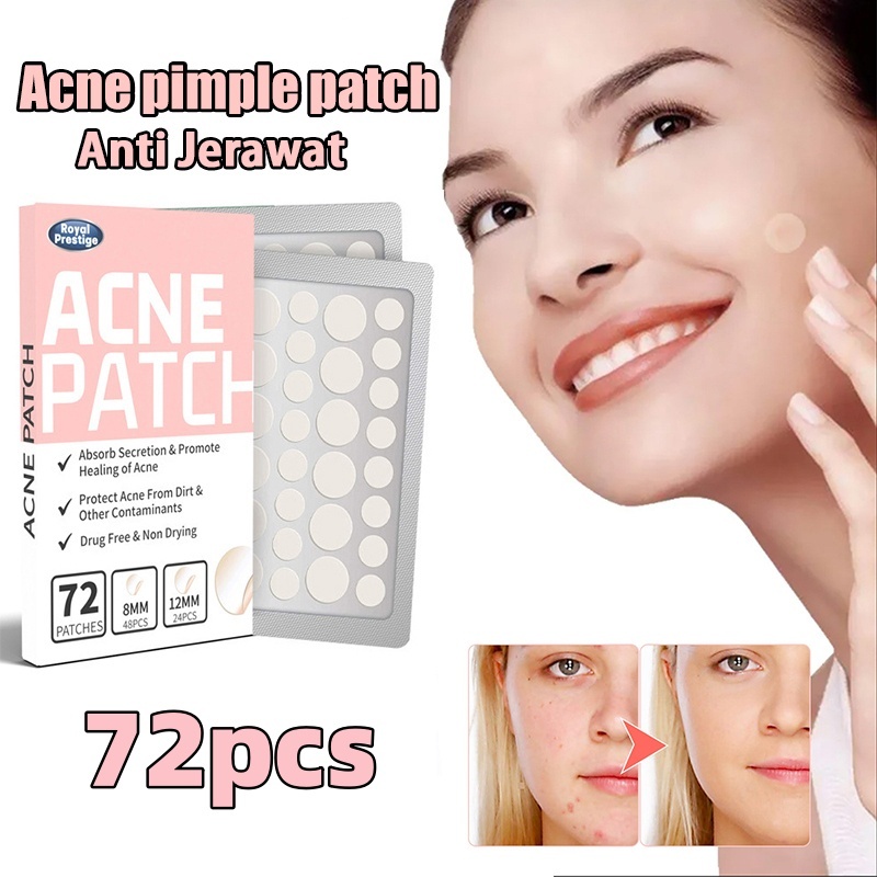 Jual 72Pcs Acne Patch Acne Pimple Patch Sticker Jerawat Pimple Patch ...