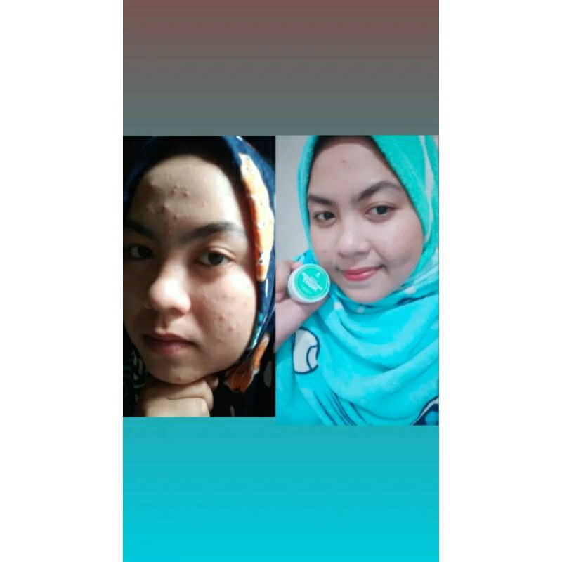 Jual Night Cream Moizturizer Fifab Glow Free Sabun (BPOM) 100% | Shopee ...