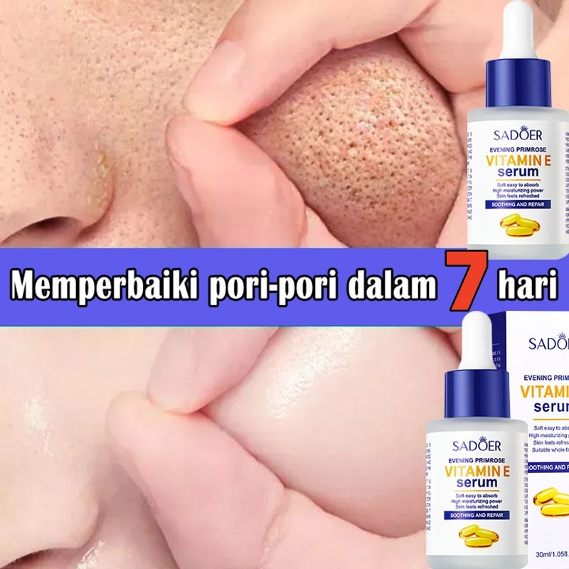 Jual Serum Pengecil Pori 30ml Vitamin E Serum Wajah Glowing Pemutih Mengecilkan Pori Anti ...