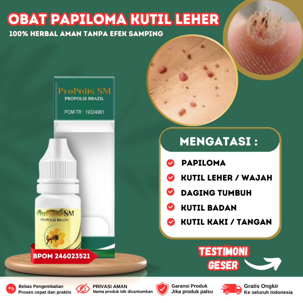 Jual Obat Papiloma / Skin tag Kutil di leher, Penghilang Papiloma leher ...