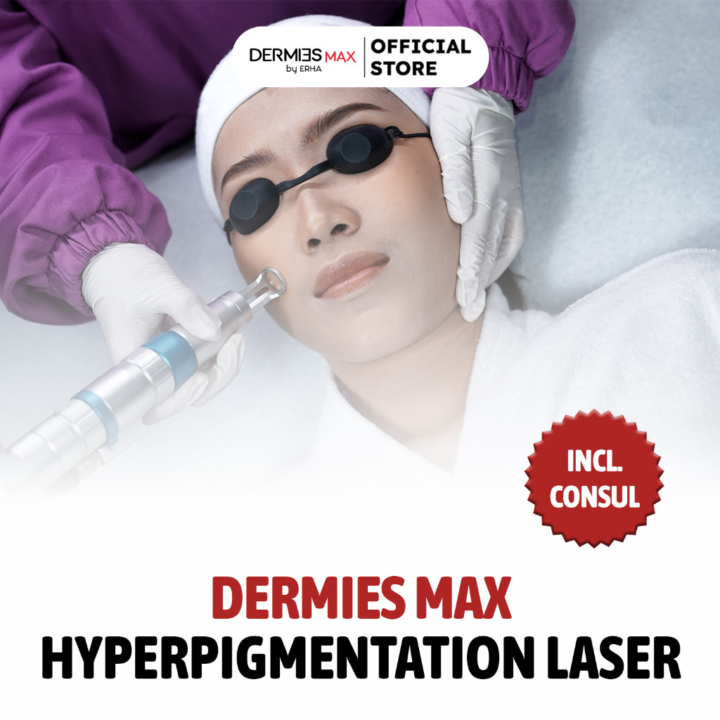 Jual Dermies Max Hyperpigmentation Laser | Shopee Indonesia