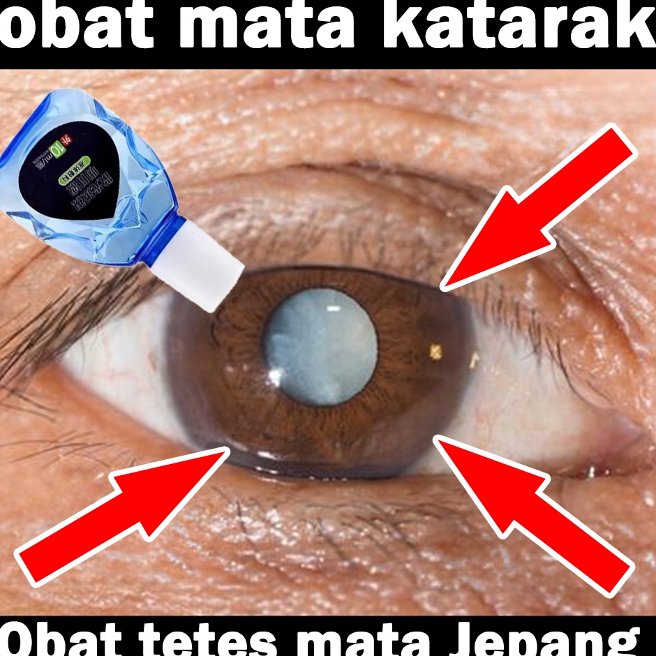 Jual KODE J75A obat mata katarak obat tetes mata katarak obat tetes ...