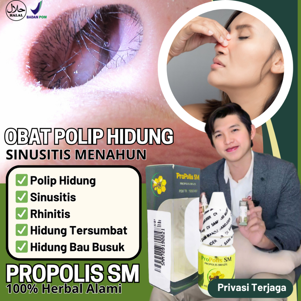 Jual Obat Polip Hidung Sinusitis Rhinitis Hidung Bau Busuk Hidung Bengkak Dan Berair Pilek ...