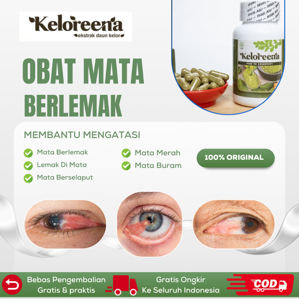 Jual Obat Mata Berlemak Pterygium Mata Merah Dan Berselaput Penghilang ...