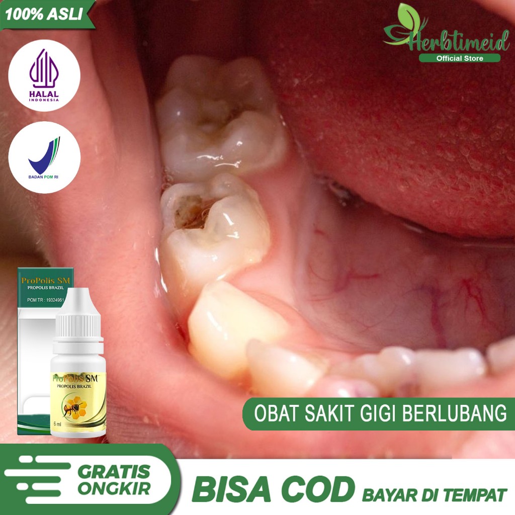 Jual Obat Sakit Gigi Berlubang Gusi Bengkak Nyeri Linu Bau Mulut Tak ...