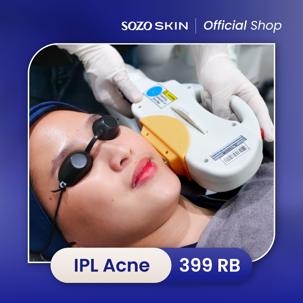 Jual SOZO SKIN IPL Acne | Shopee Indonesia