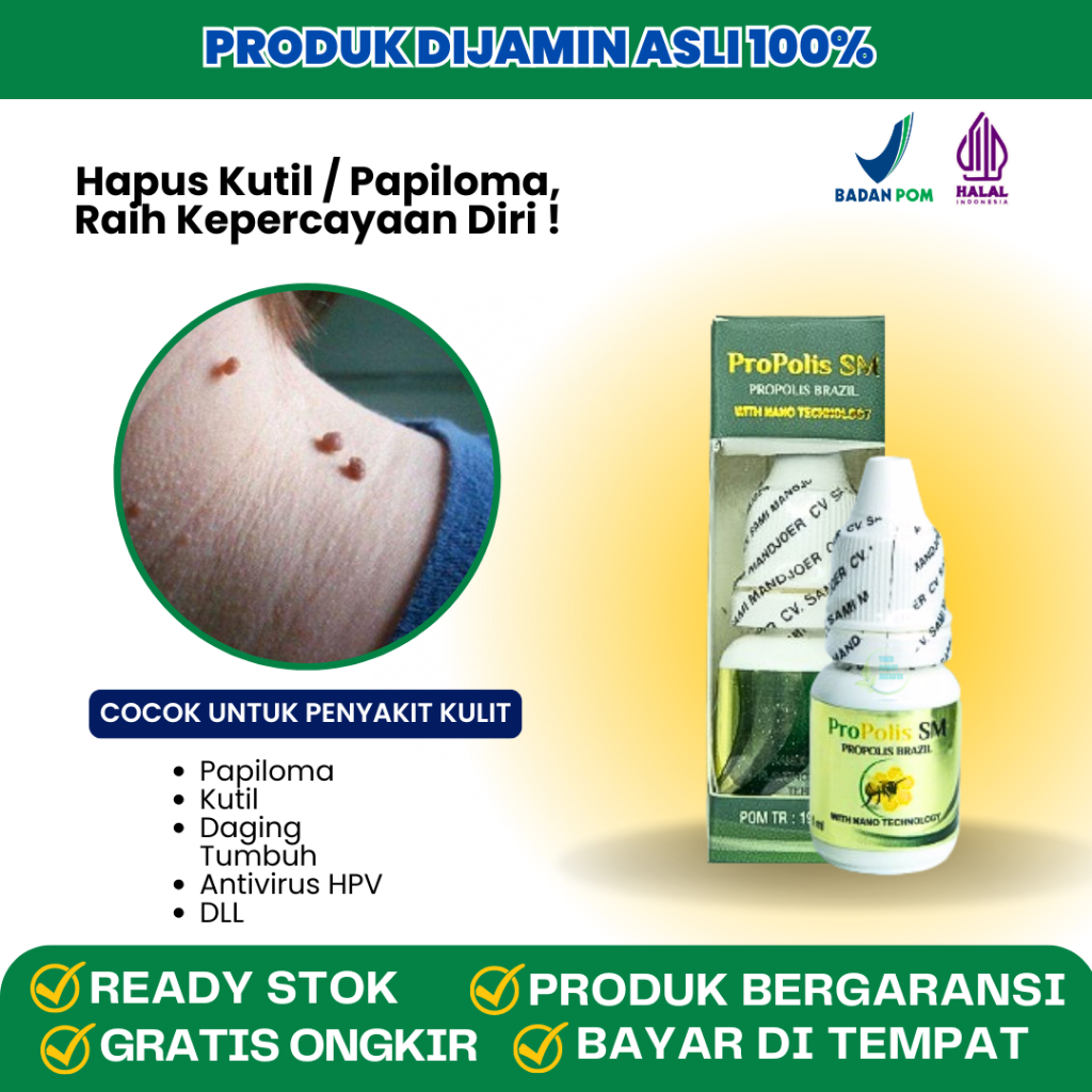 Jual Obat Papiloma Antivirus HPV Yang Diminum | Shopee Indonesia