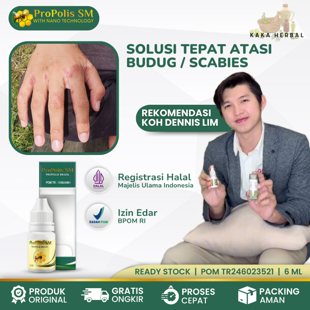 Jual Kaka Herbal - Obat Budug, Scabies, Buduk, Gudik / Gudig, Obat ...