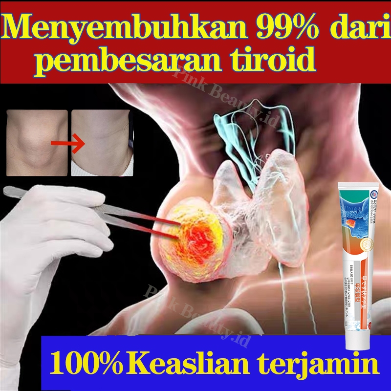 Jual Krim Tiroid 20g Obat Gondok Kelenjar Tiroid benjolan di leher ...