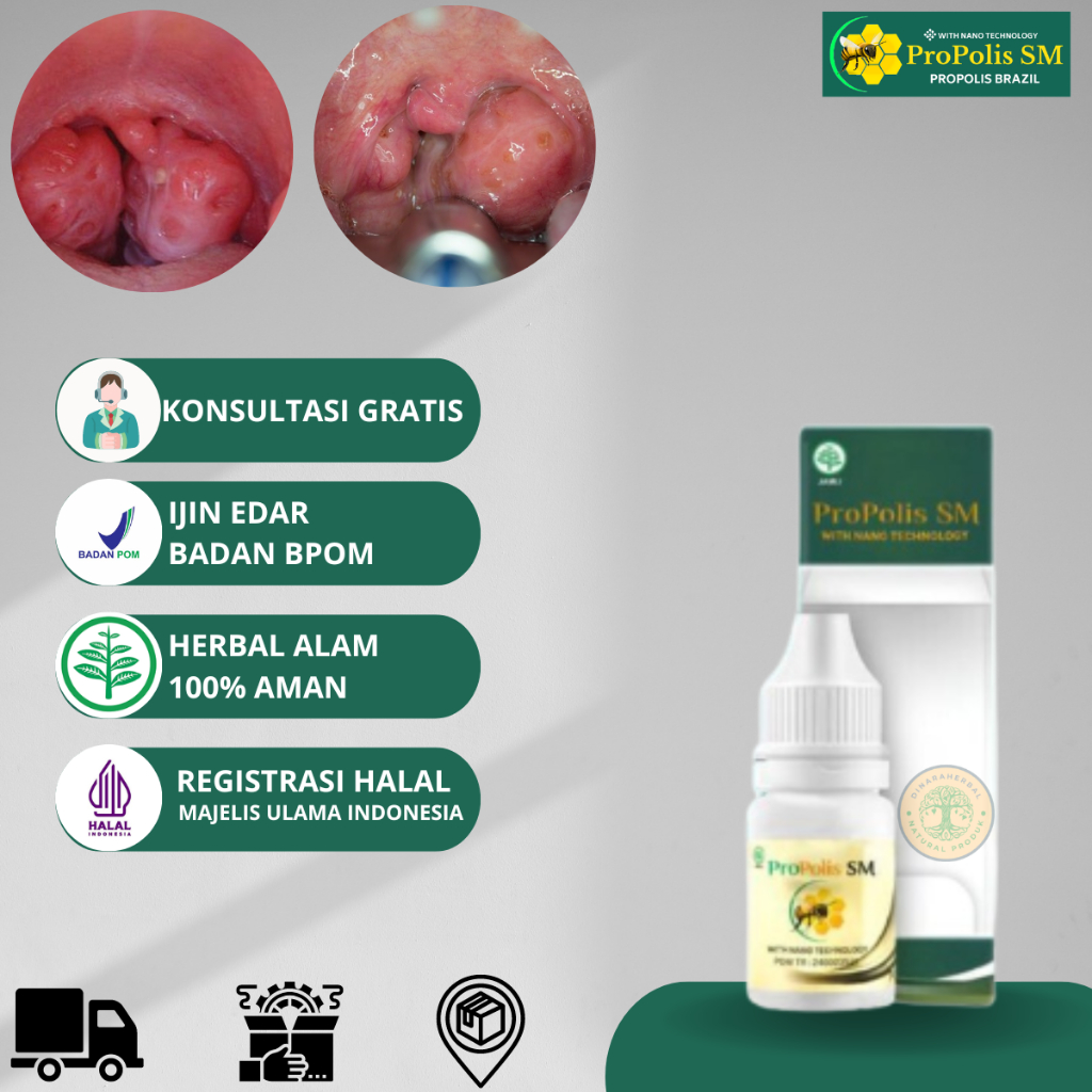 Jual Obat Herbal Khusus Amandel Anak dan Dewasa , Sakit Menelan, Radang ...