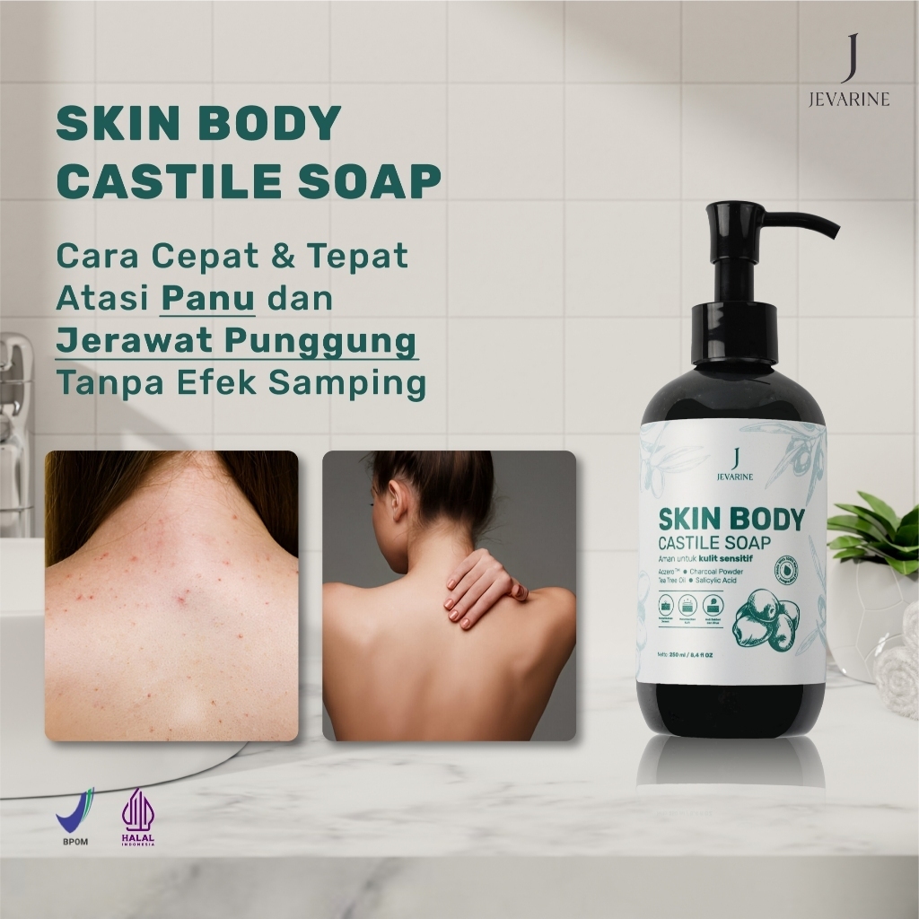 Jual Jevarine Body Castile Soap Sabun Mandi Mengatasi Kulit Punggung ...