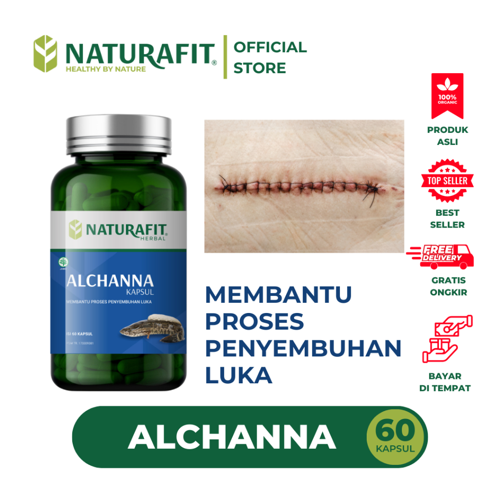 Jual Alchanna Kapsul Kutuk Premium Albumin Sembuhkan Luka Operasi Ekstrak Ikan Gabus Penyembuh ...
