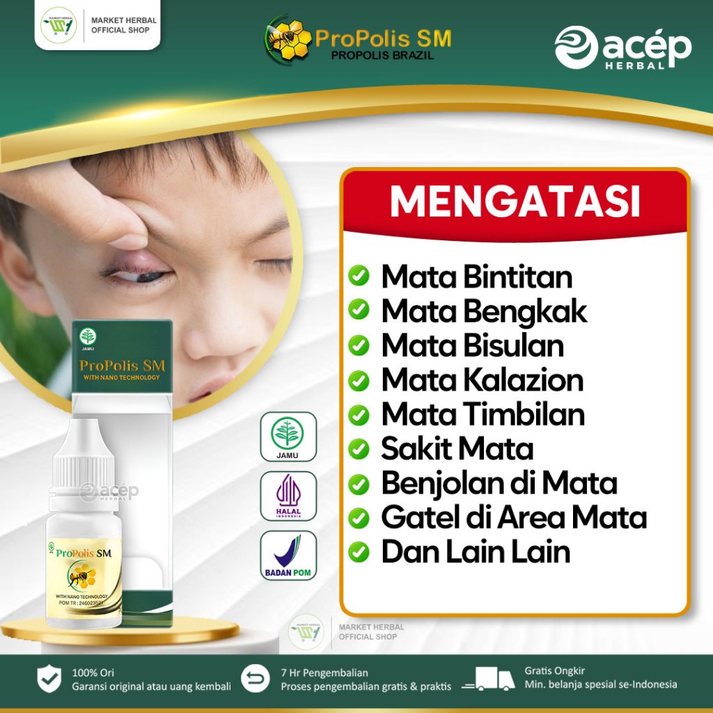 Jual Obat Mata Bintitan, Kalazion, Mata Bengkak, Benjolan di Kelopak ...