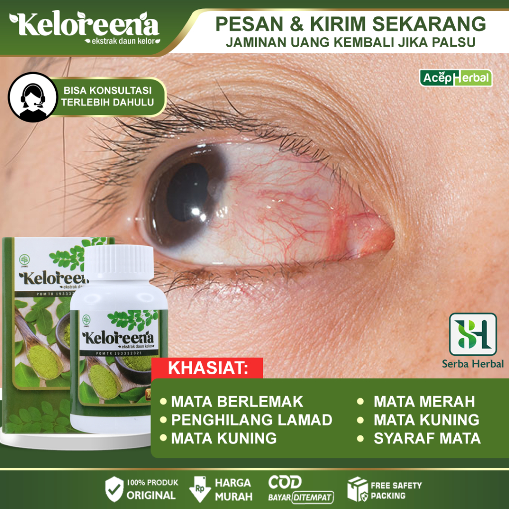 Jual Obat Mata Berlemak, Pembersih Pterigium, Pterygium, Penghilang ...