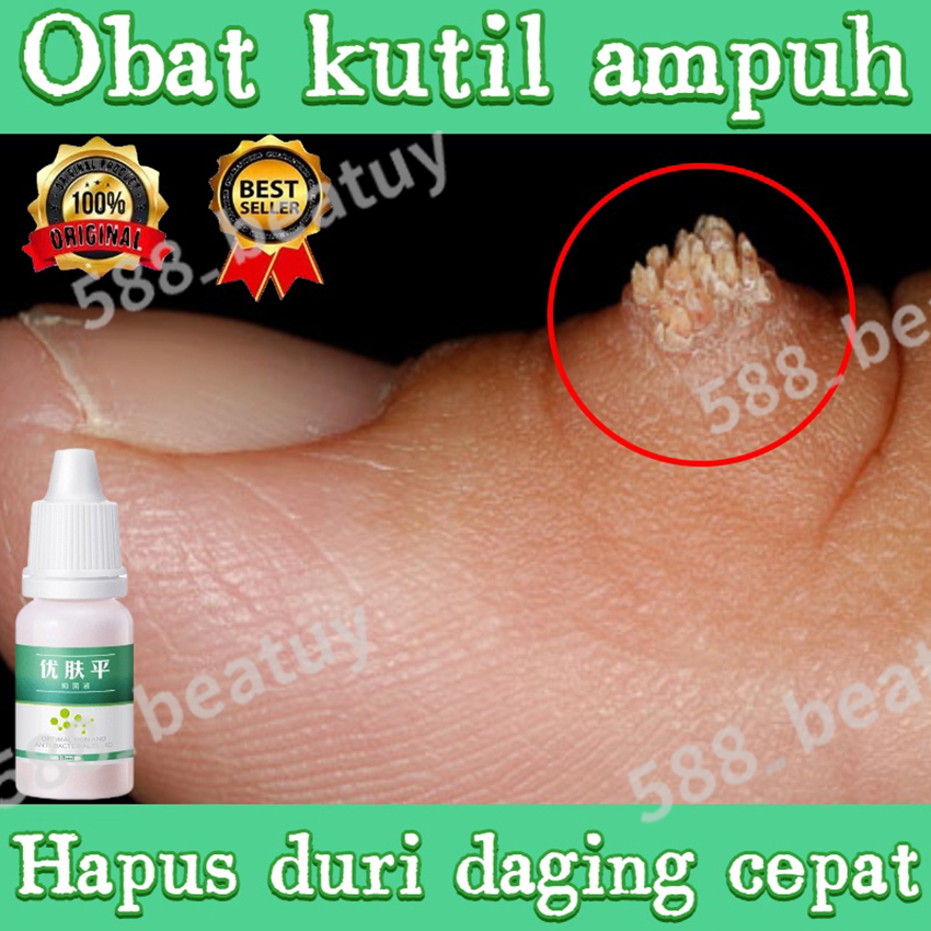 Jual Obat kutil Obat kutil kelamin Obat kutil wajah Penghilang kutil ...