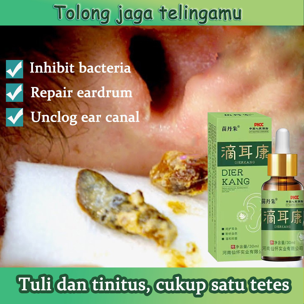 Jual Obat tetes telinga obat tetes telinga kotoran keras obat telinga ...
