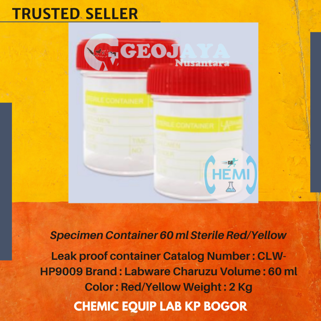Jual Specimen Container 60 ml Sterile Red/Yellow | Shopee Indonesia