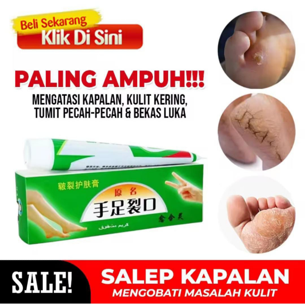 Jual Salep Ijo Ampuh Kaki Kulit Kering Jamur Kutu Air Pecah Pecah Ampuh ...