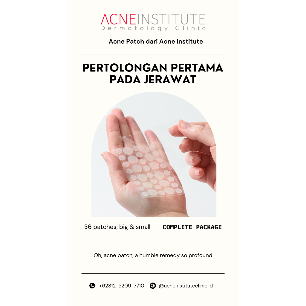 Jual AIC Pimple Patch | Shopee Indonesia