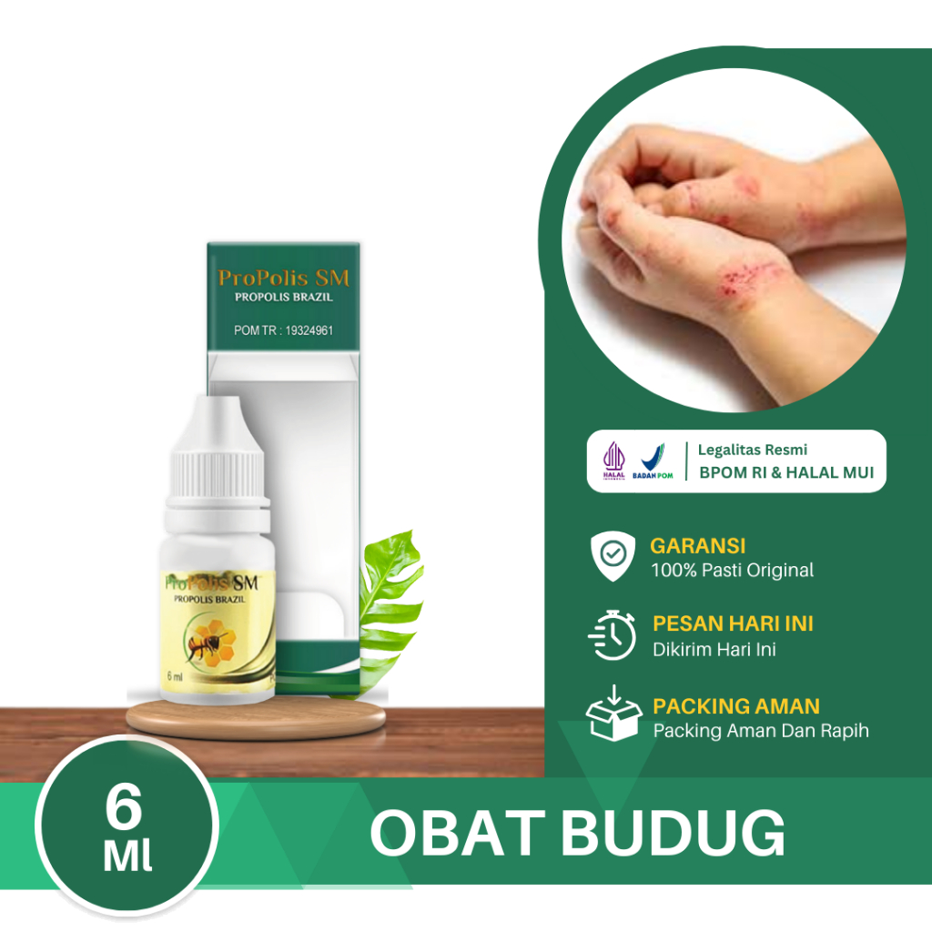 Jual Obat Oles Budug, Pembasmi Kutu Skabies, Obat Budug Santri, Obat ...