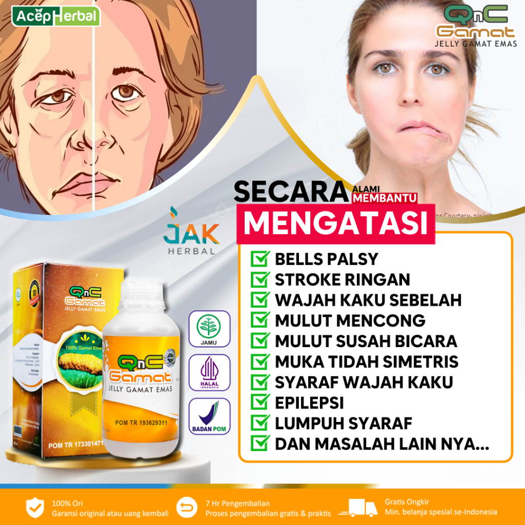 Jual Obat Bells Palsy Stoke Ringan Wajah Miring Tidak Simetris Bibir ...